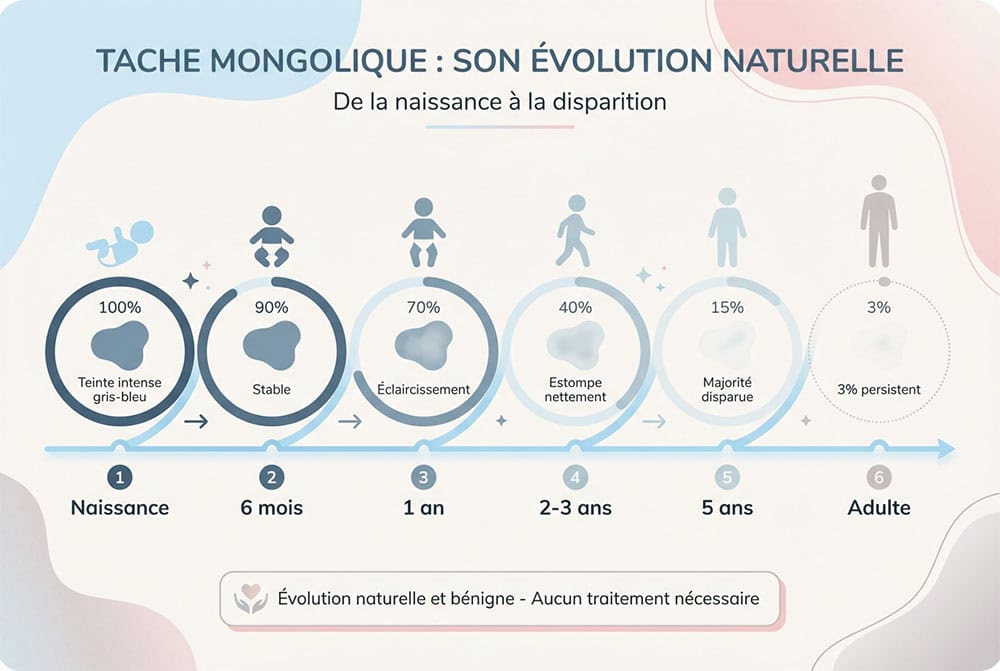 Comprendre la tache mongolique chez le nouveau-né : origines et ...